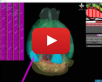 Live Demo: 4-Shank Probe Trajectory Planning | Pathfinder, Pinpoint ...